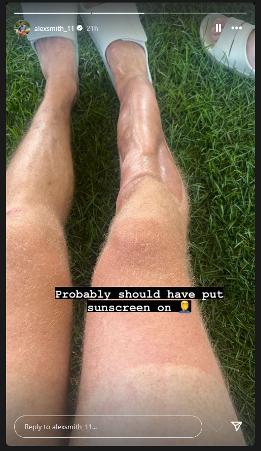 Former NFL Quarterback Reveals Gruesome Photo of Injured Leg - Athlon ...