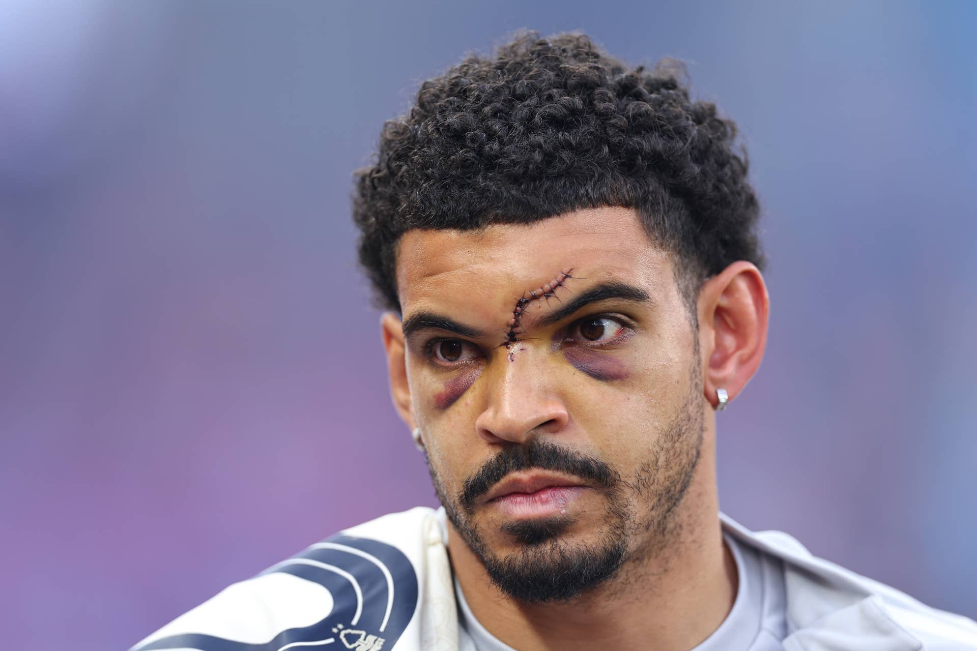 What Happened to Morgan Gibbs-White's Face? Know the Story Behind the ...