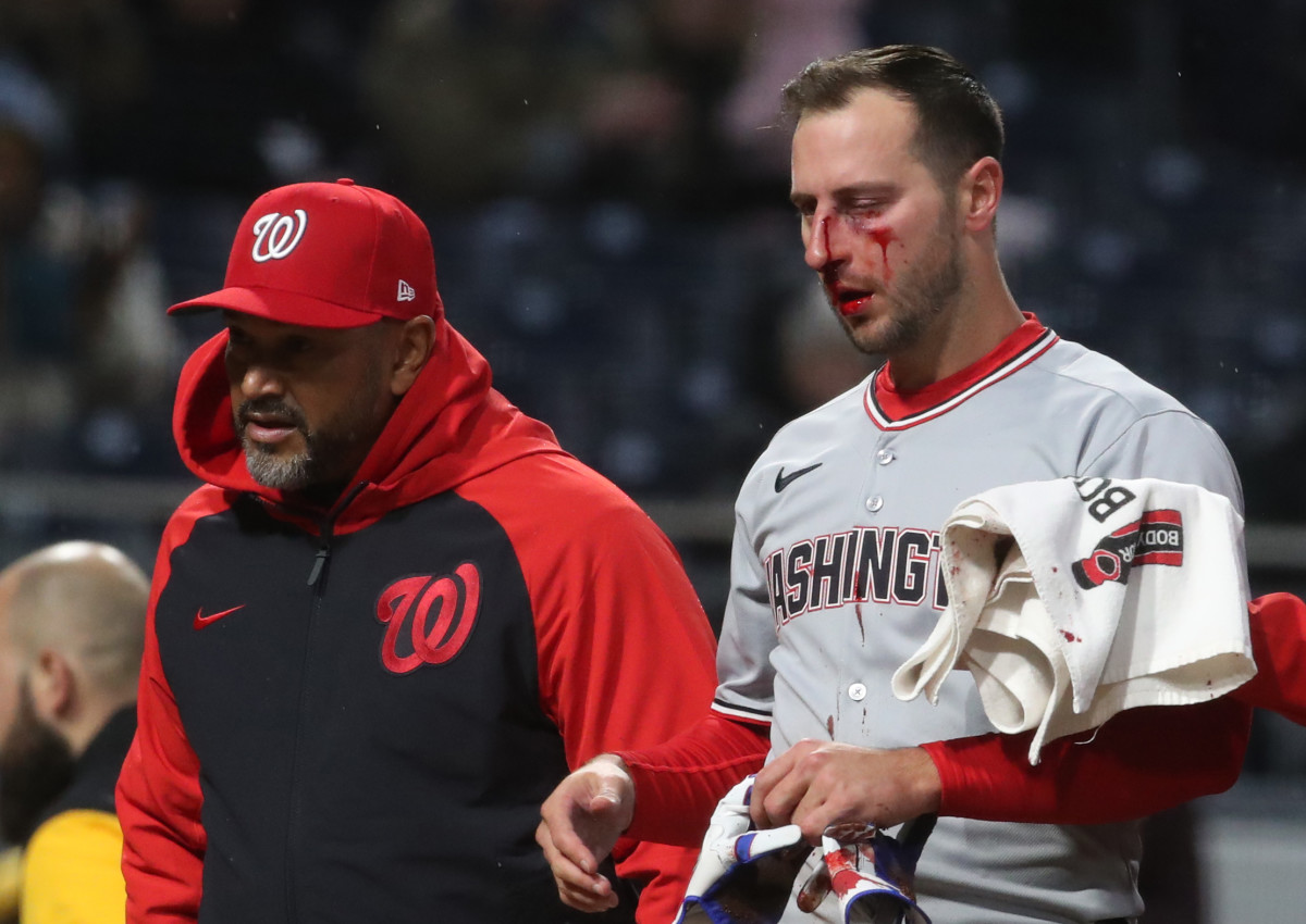 Nationals Third Baseman to Injured List after Being Hit in Face with ...